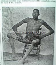 Manusia-Manusia Paling Tinggi di Dunia